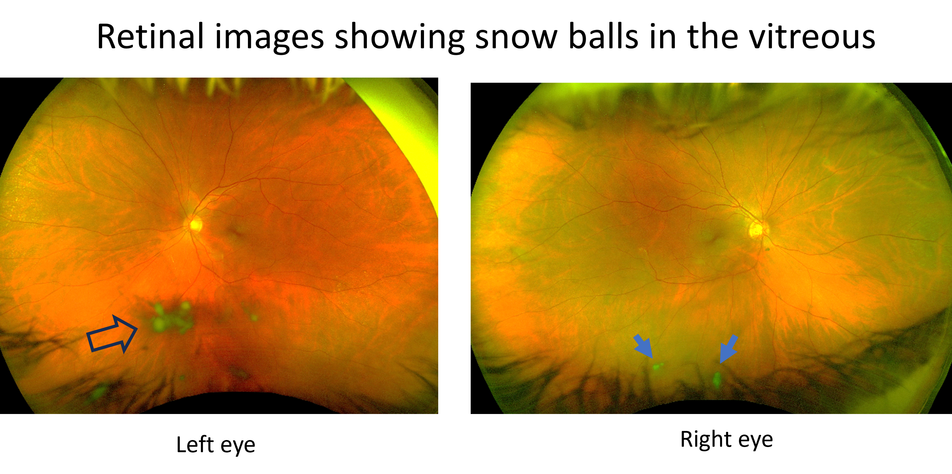 Weird eye problems – Boston Eye Blink