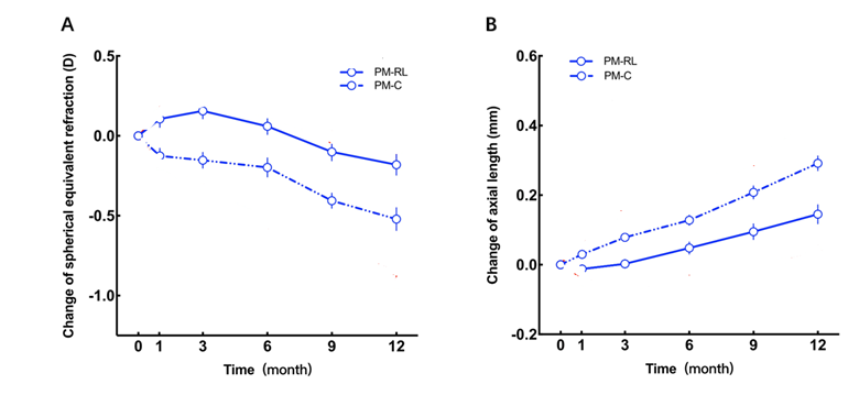 Can red light therapy prevent myopia development? – Boston Eye Blink